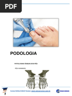 Tórax Tonel, Pectus Carinatum e Pectus Exacavatum | PDF | Doença de ...