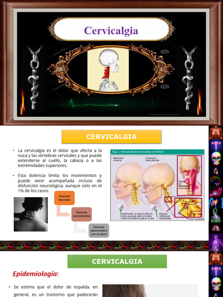 cervicalgia (1) | PDF | Dolor lumbar | La columna vertebral