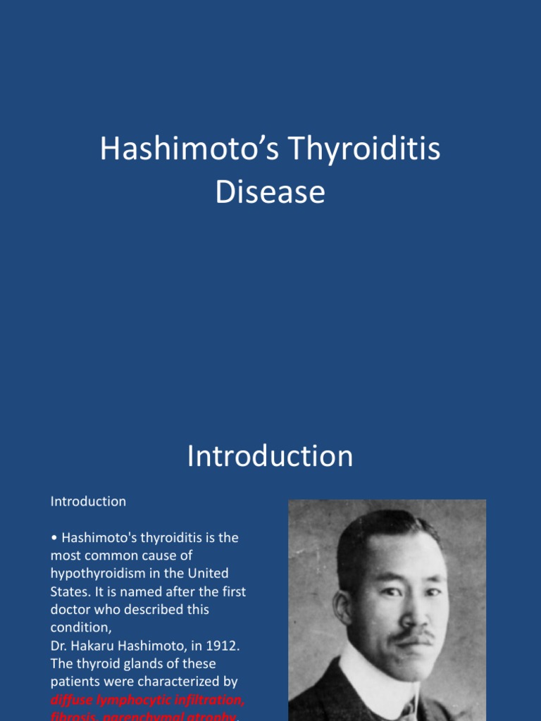 Hashimoto and Grave Disease | Hypothyroidism | Thyroid