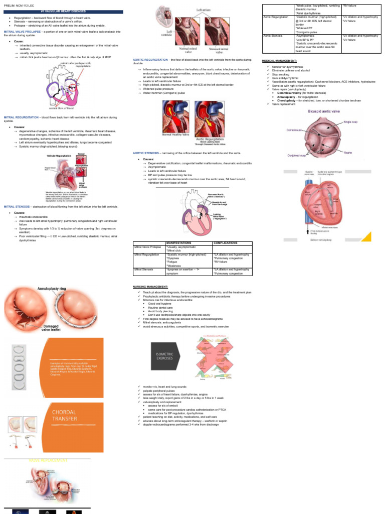 NCM 114 Lec Prelim Notes | PDF | Coronary Artery Bypass Surgery ... NCM 114 Lec Prelim Notes | PDF | Coronary Artery Bypass Surgery ...