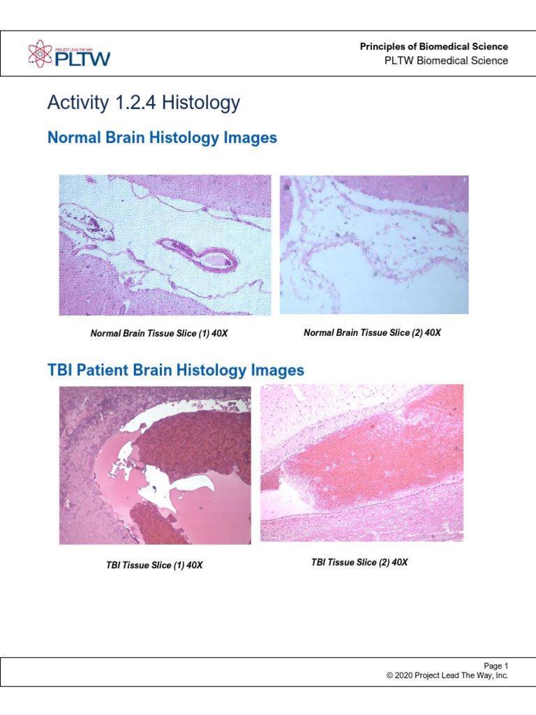 Brain Histology: Normal vs. TBI | PDF