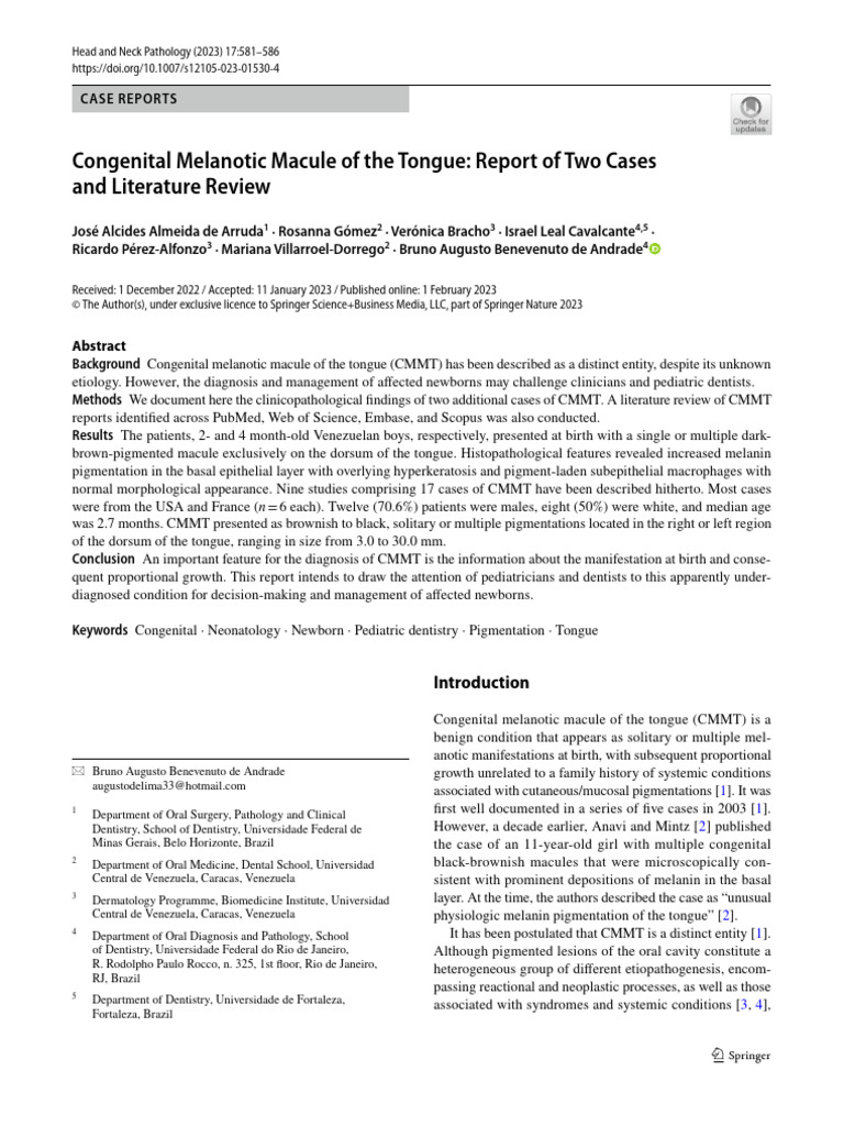 Congenital Melanotic Macule of The Tongue Report of Two Cases | PDF | Melanoma | Medicine