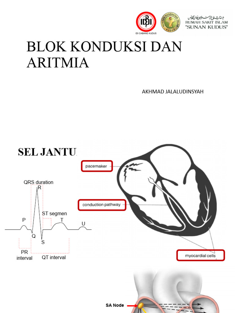 Blok Konduksi Dan Aritmia | PDF | Cardiovascular Physiology | Cardiac Electrophysiology
