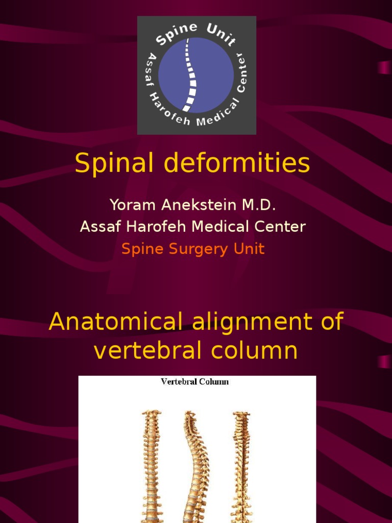 Spinal Deformities: Types and Treatments | PDF | Scoliosis | Medical ...