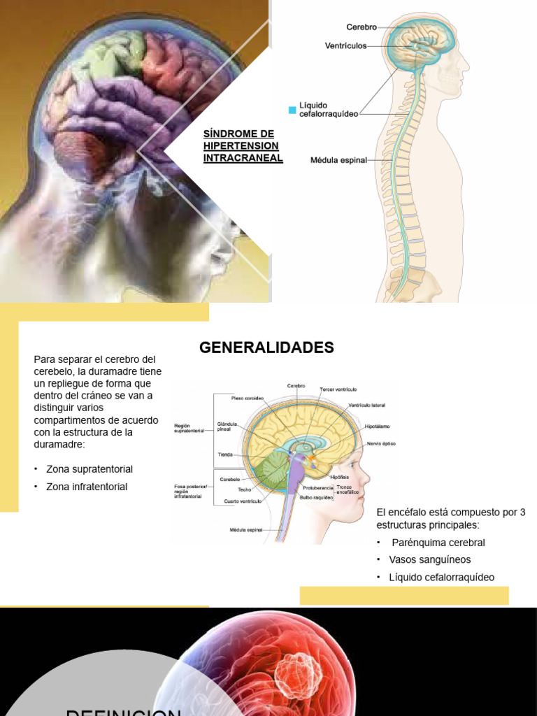 Exposicion de Hipertension Intracraneal | PDF | Fluido cerebroespinal | Neurología