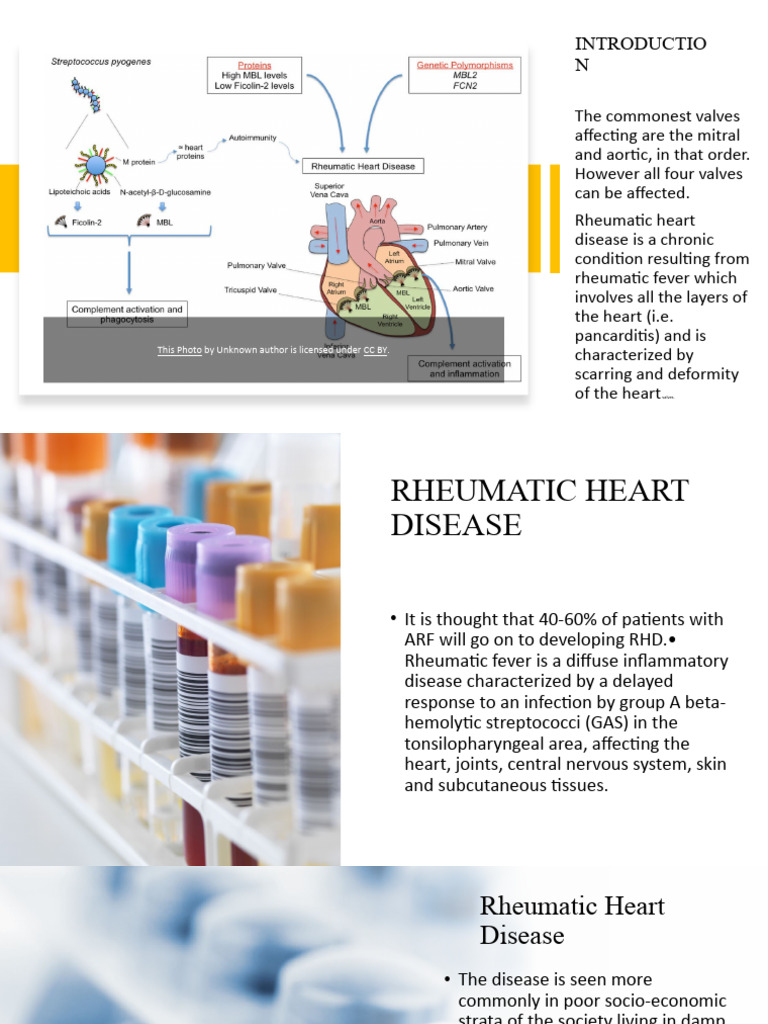 Understanding Rheumatic Heart Disease Pdf Heart Heart Failure
