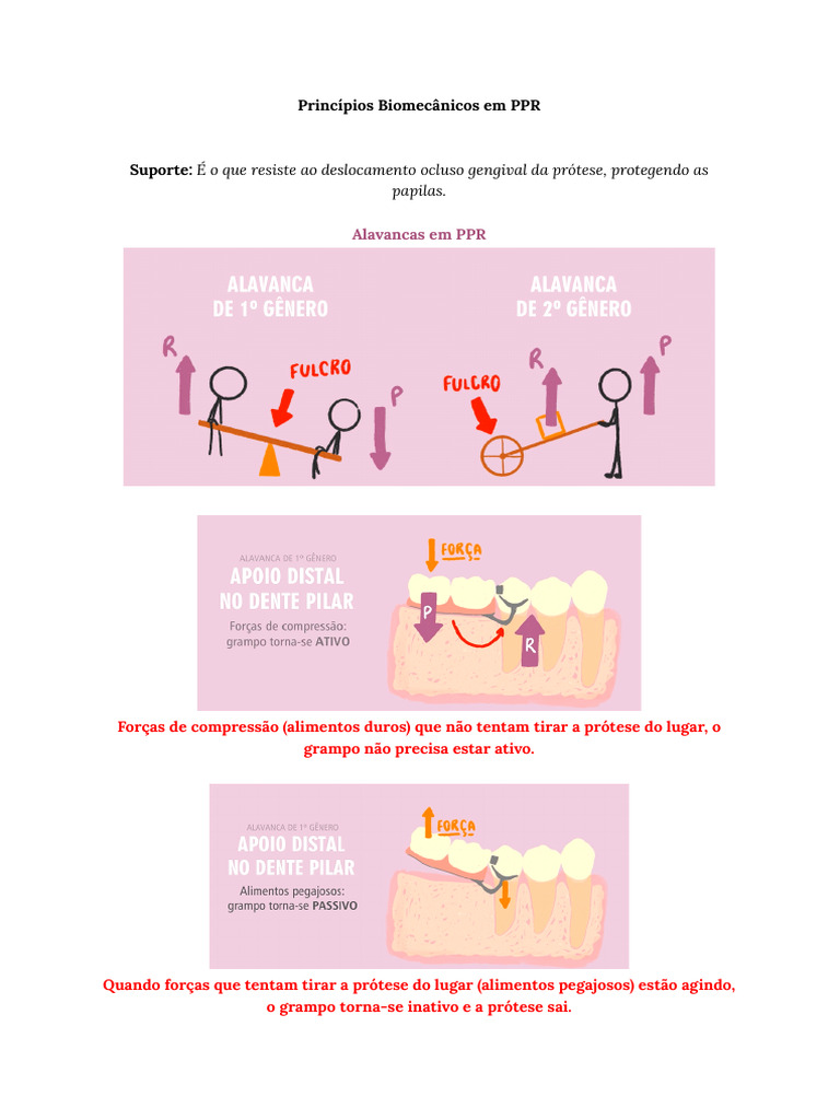 Princípios Biomecânicos em PPR | PDF | Prótese | Ciências Físicas