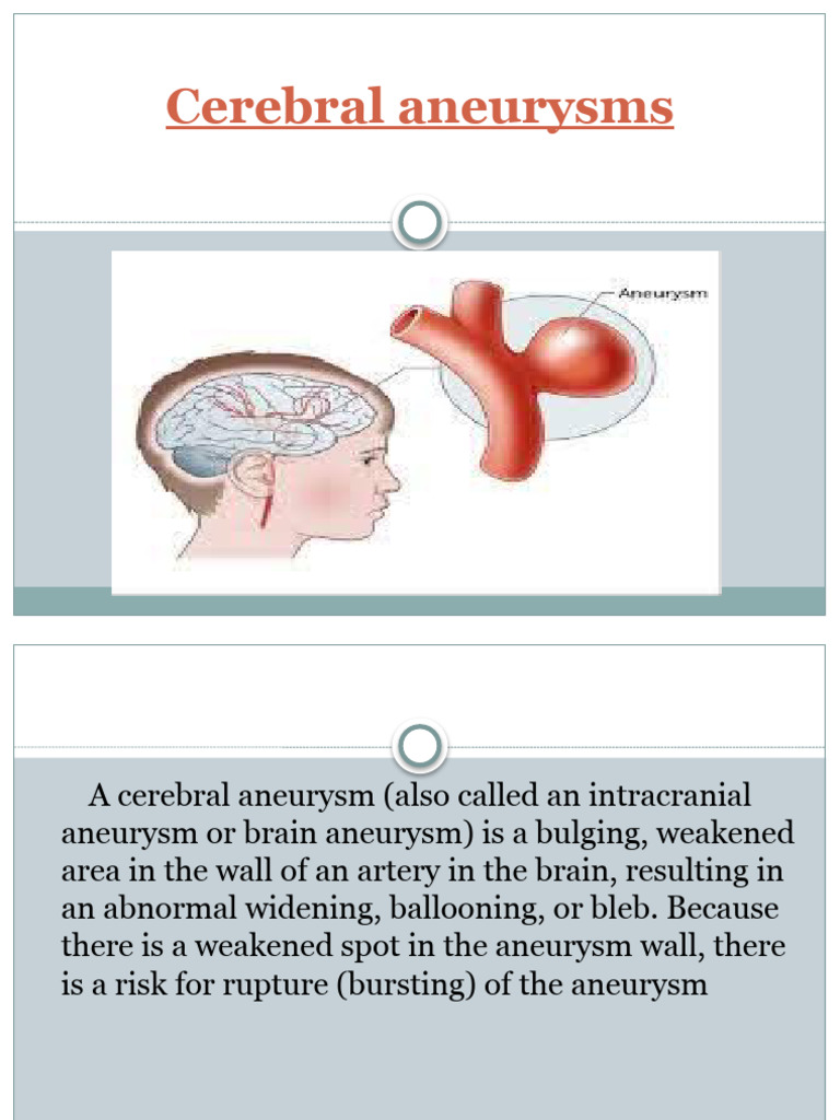 Cerebral Aneurysms | PDF | Nervous System | Angiology