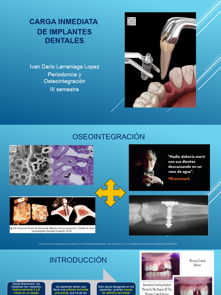 Presentación Carga Inmediata IDLL | PDF | Dentadura postiza | Ramas de ...