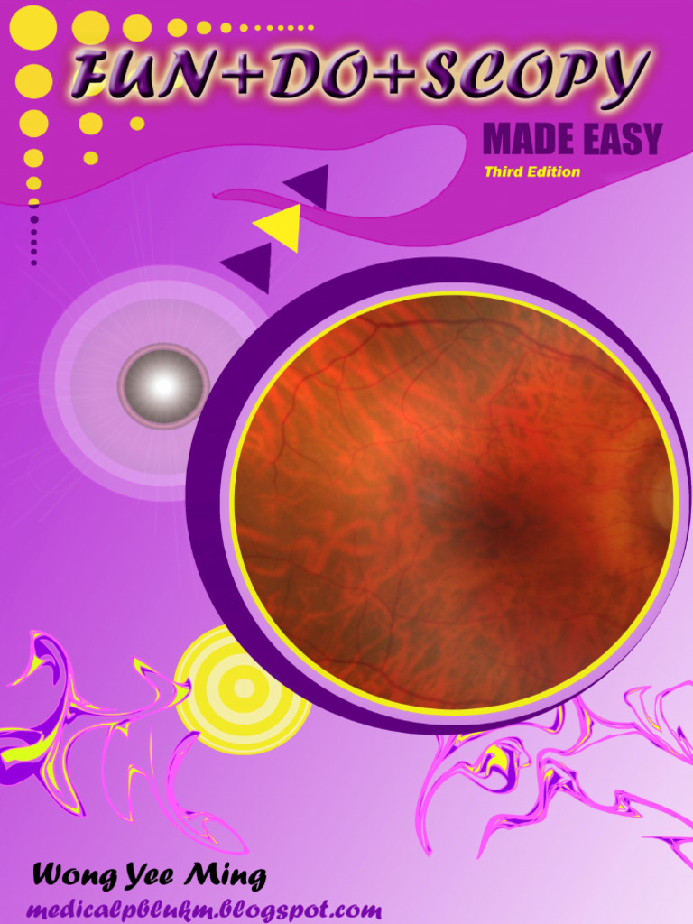 Fundoscopy Made Easy | PDF | Retina | Human Eye