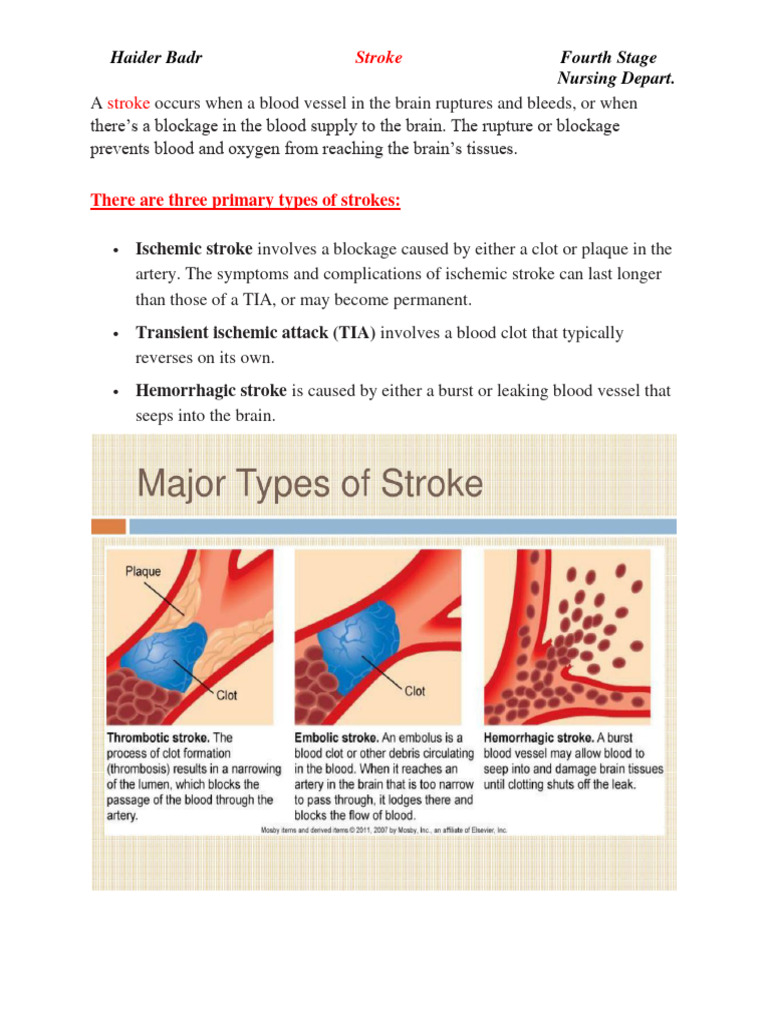 Stroke | PDF | Stroke | Ischemia