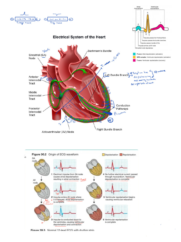 Note ECG CH 6 Critical | PDF