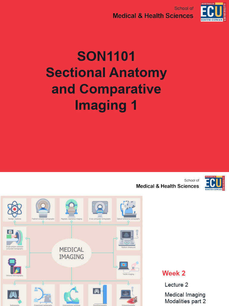 Medical Imaging Modalities Overview | PDF | Positron Emission Tomography | Magnetic Resonance ...