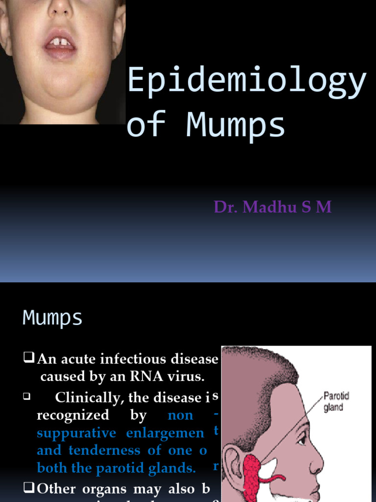 Epidemiology of Mumps | PDF | Infection | Medicine