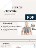 Clasificación de Fracturas de Clavícula Allman | PDF | Historia