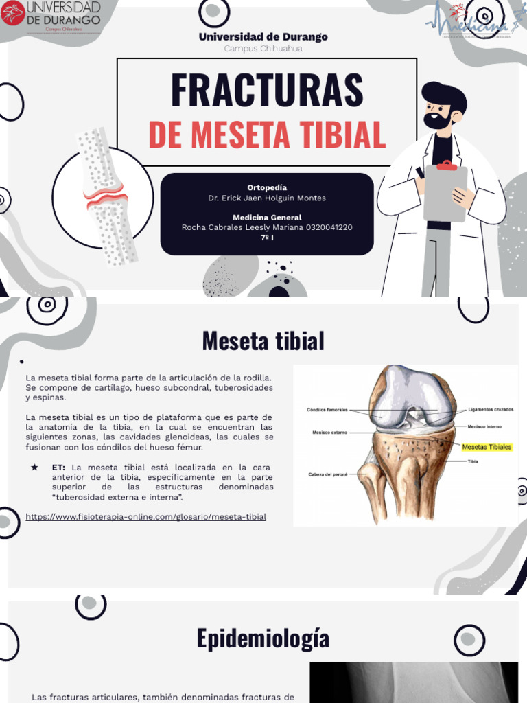 Fractura de Meseta Tibial | PDF | Rodilla | Sistema musculoesquelético