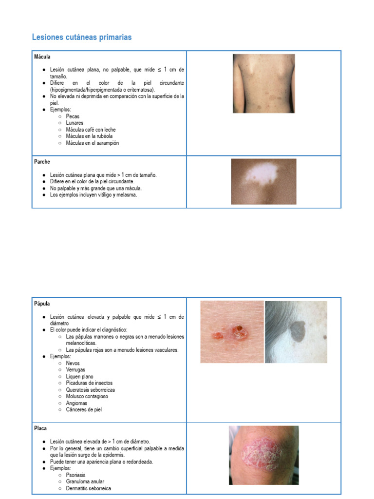 Tipos y Ejemplos de Lesiones Cutáneas | PDF | Piel | Medicina CLINICA