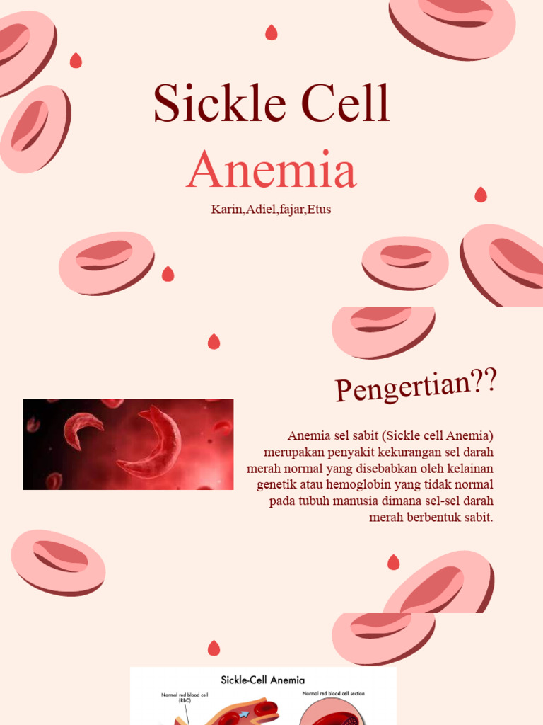 Sickle Cell Anemia-1 | PDF
