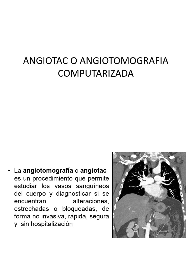 Angiotac: Diagnóstico de Vasos Sanguíneos | PDF
