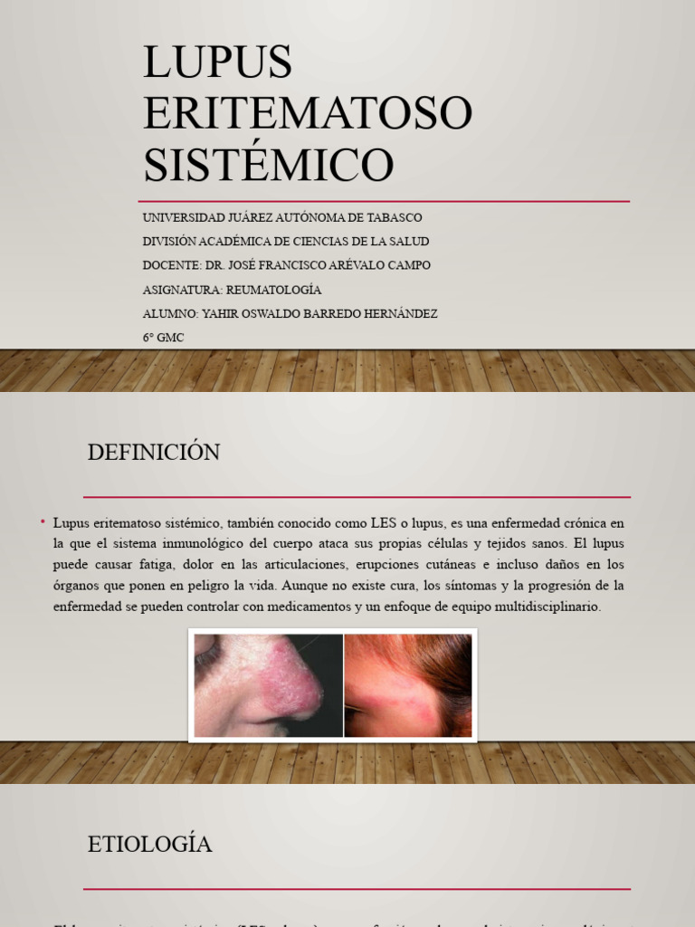 Lupus Eritematoso Sistémico: Definición y Tratamiento | PDF | Sistema ...