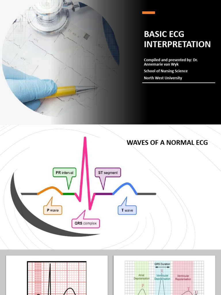 Basic ECG Interpretation for Nurses | PDF | Electrocardiography | Heart ...