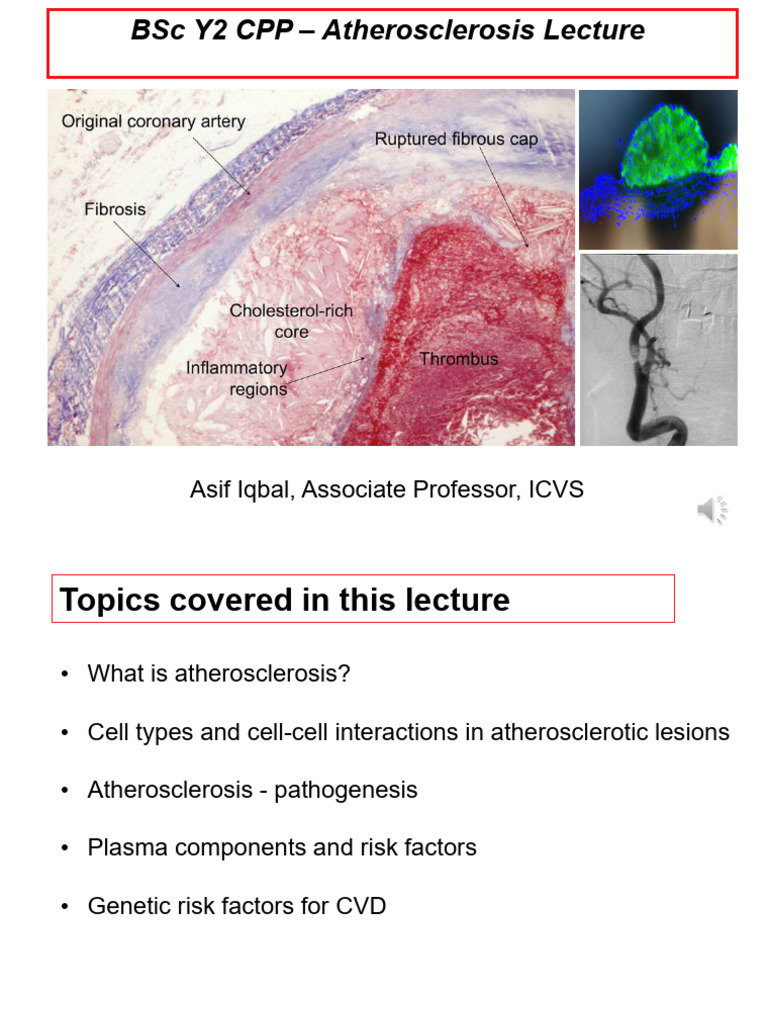 Atherosclerosis 2023 CPP Lecture | PDF | Atherosclerosis | High Density Lipoprotein