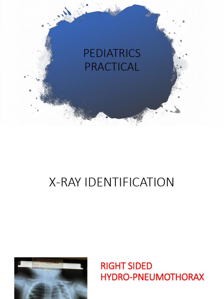 Pediatrics Practical | PDF | Fat | Intravenous Therapy