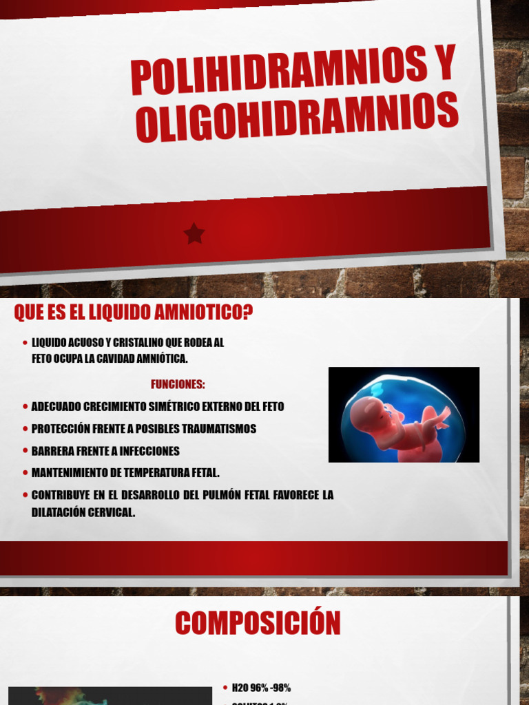 Polihidramnios y Oligohidramnios: Guía Completa | PDF | El embarazo | Feto