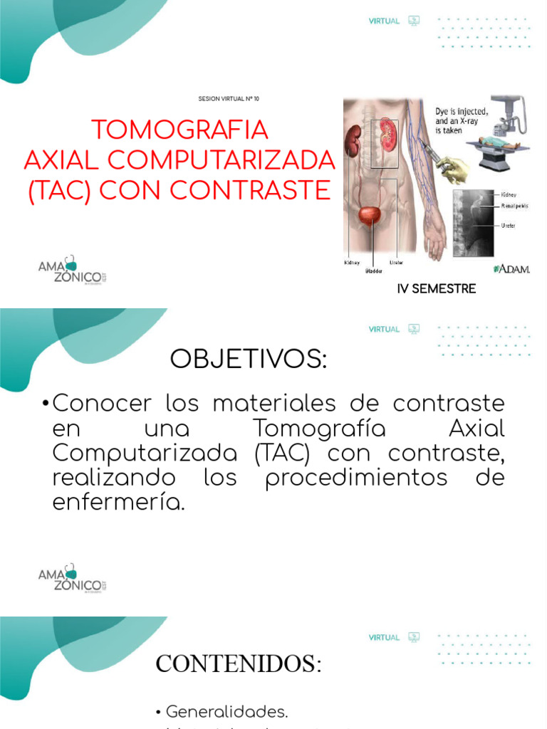 Sesion Virtual 10 - Tac Con Contraste | Descargar gratis PDF | Ct Scan ...