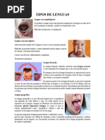 Microglosia y Macroglosia | PDF | Inflamación | Lengua