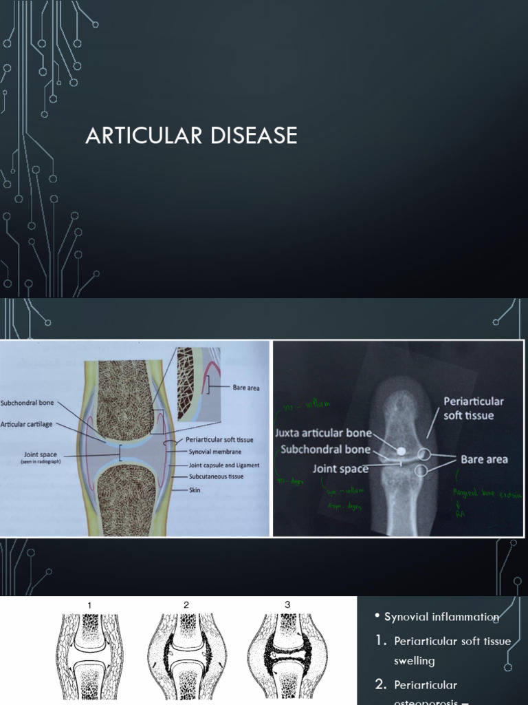 Articular Disease | PDF