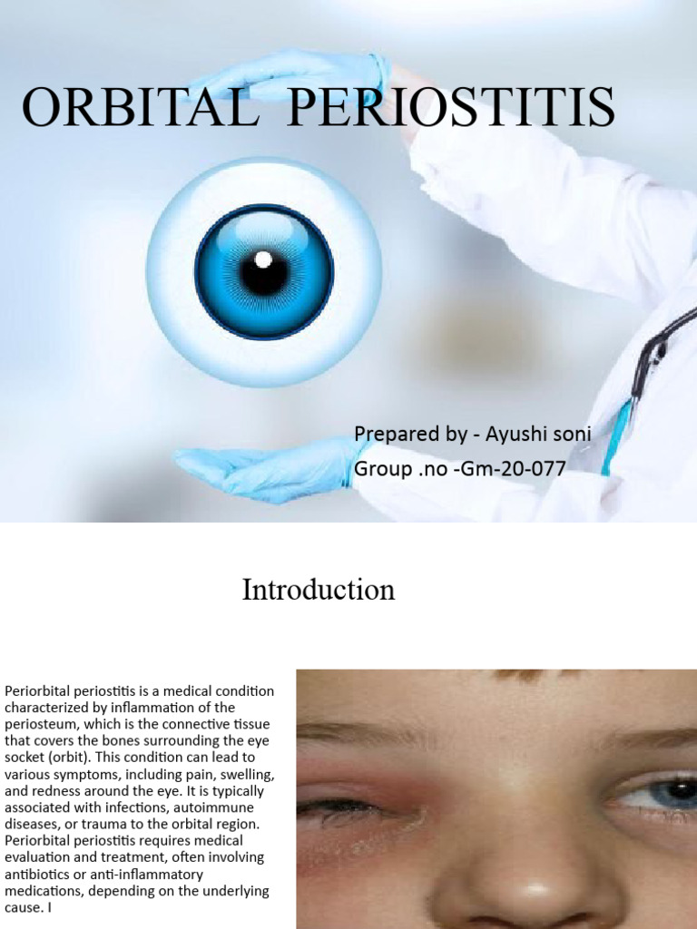 Ayushi Soni Periostitis | PDF | Inflammation | Allergy