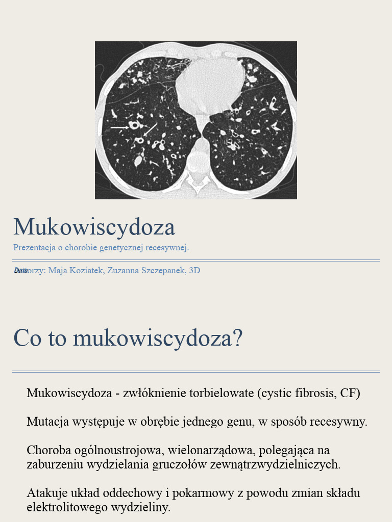 Mukowiscydoza 3 D | PDF
