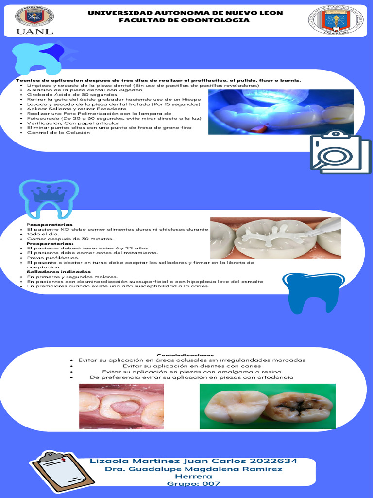Aplicación de Selladores Dentales en Niños | PDF