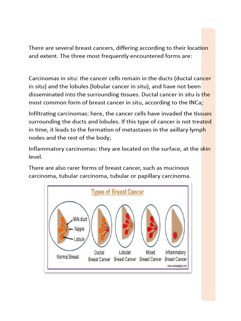 Breast Cancer | PDF