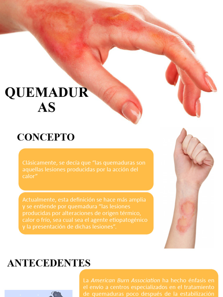 Clasificación y tratamiento de quemaduras | PDF | Quemar | Herida