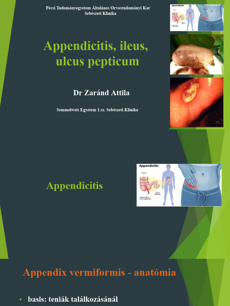 Appendicitis, Ileus, Ulcus Pepticum | PDF