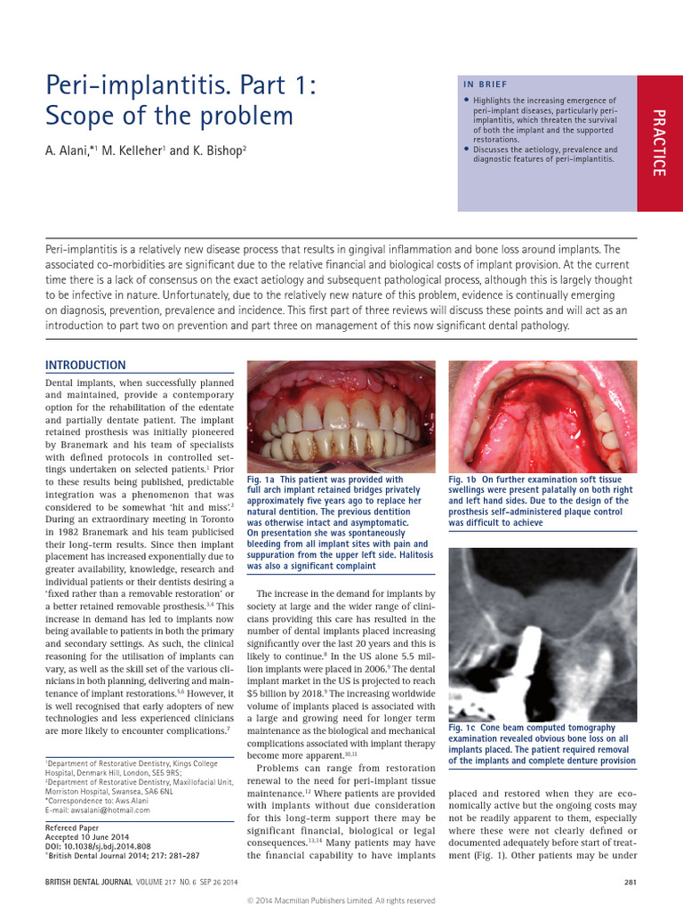 Peri-Implantitis Artikel 7-10 | Download Free PDF | Dental Implant | Medical Specialties