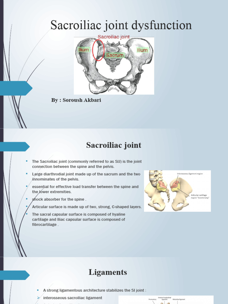 Understanding Sacroiliac Joint Dysfunction | PDF
