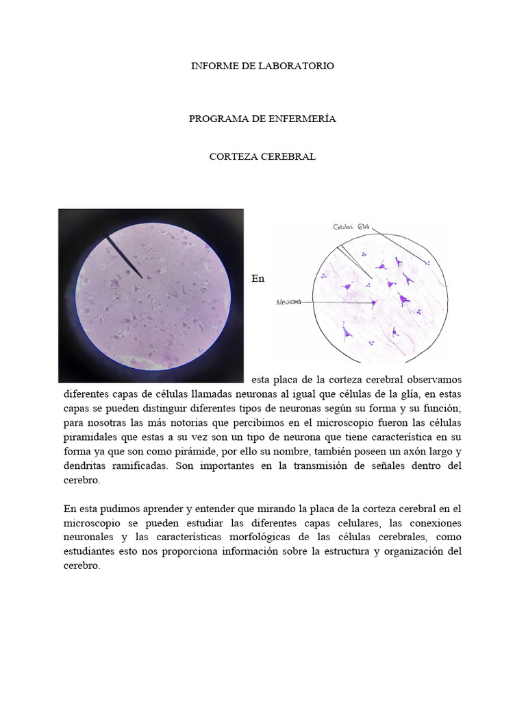 Wa0104. | PDF | Cerebelo | Cerebro