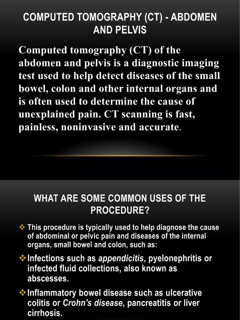 Abdomino-Pelvic CT | PDF