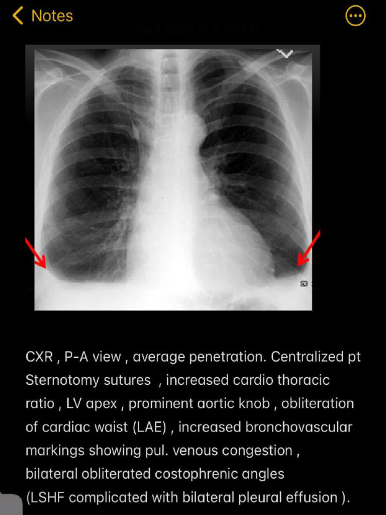 CXR Comments | PDF