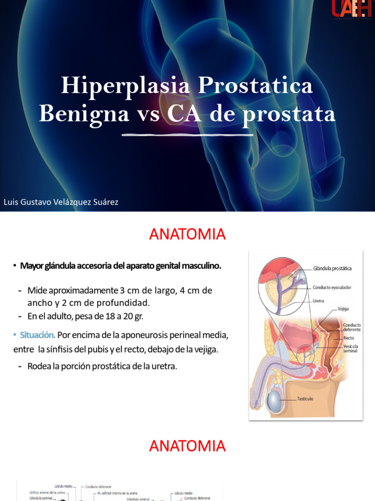 HPB y CA Prostata | PDF