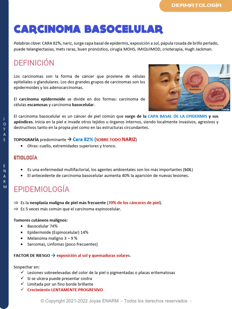 Carcinoma Basocelular | PDF | Cáncer | Piel