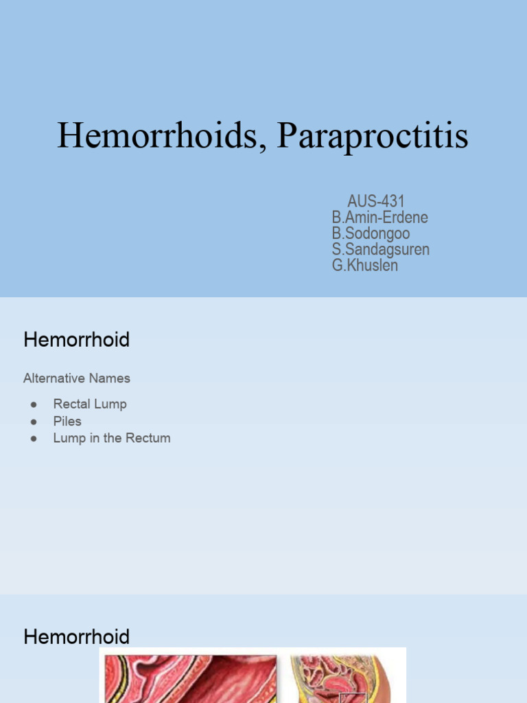 Hemorrhoids, Paraproctitis | Download Free PDF | Hemorrhoid | Gastroenterology