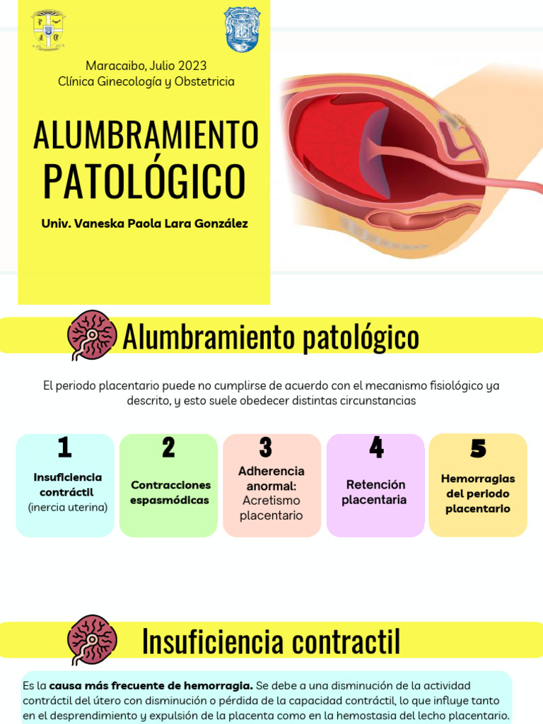 Alumbramiento Patológico | PDF | Parto | Placenta