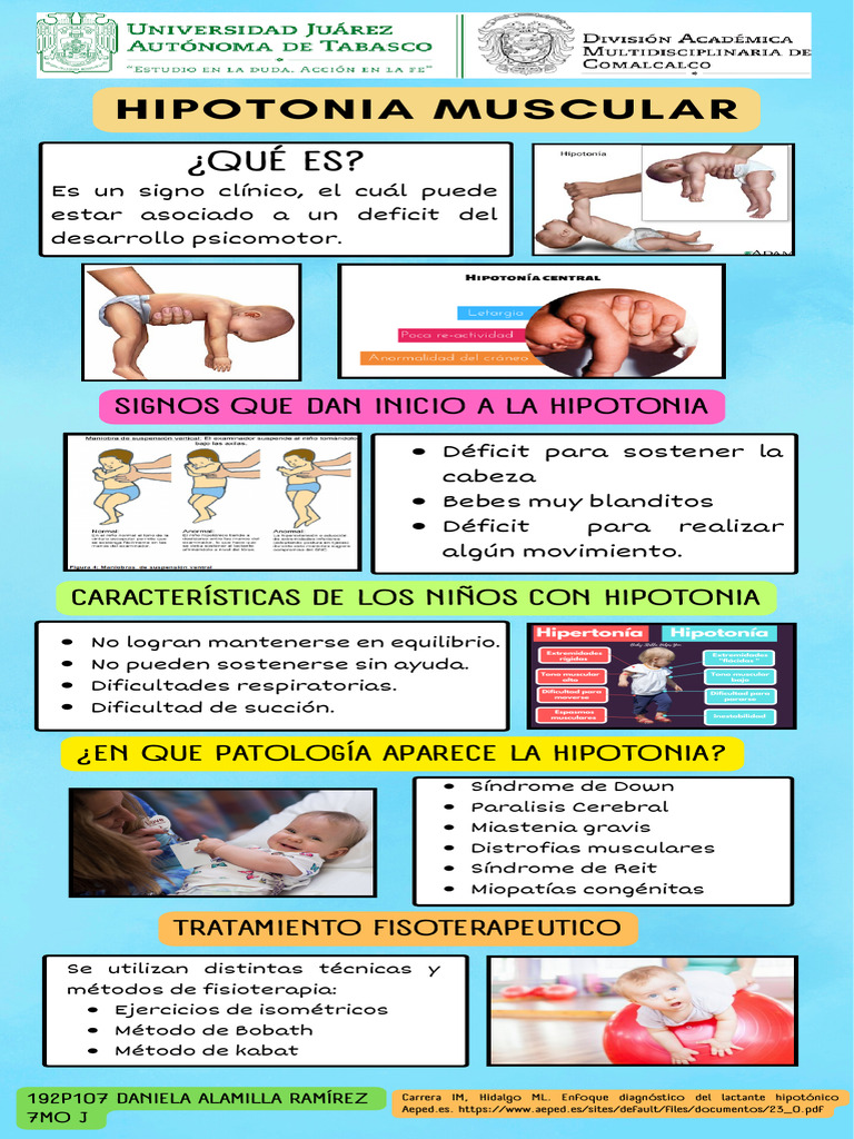 Infografia de Hipotonia y Hipertonia | PDF | Sistema nervioso ...