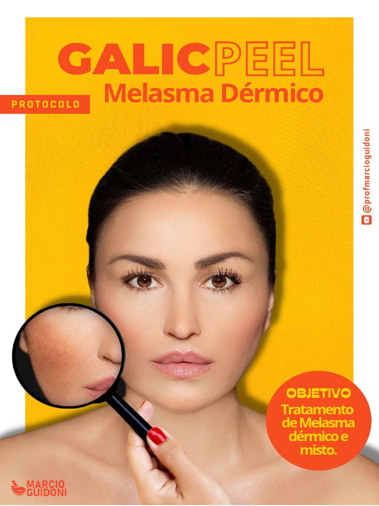 Protocolo Galic Peel para Melasma | PDF | Protetor solar | Química