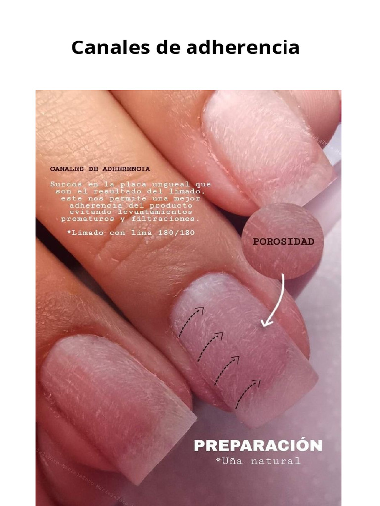 Canales de adherencia | PDF