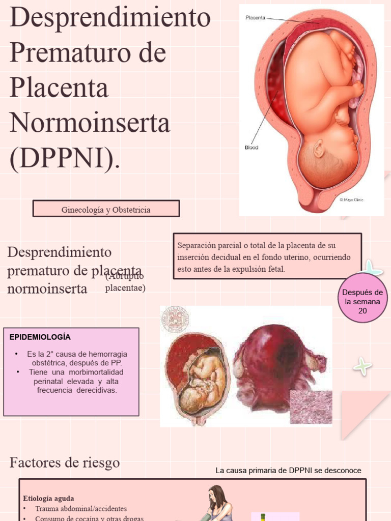 DPPNI | PDF | Parto prematuro | Parto